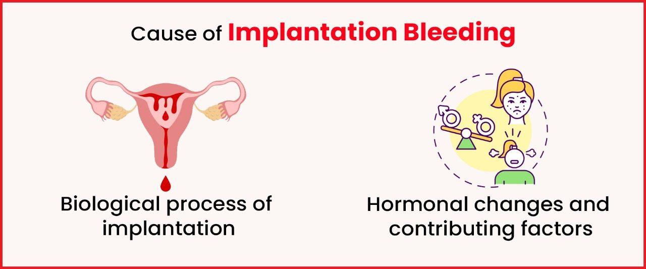 Implantation Bleeding - Causes, Symptoms, and Treatment