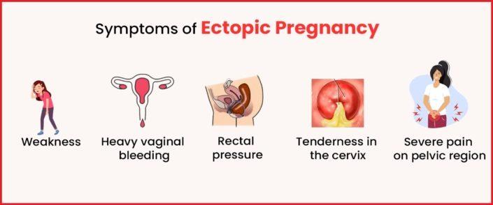 Ectopic Pregnancy - Causes, Symptoms & Treatments