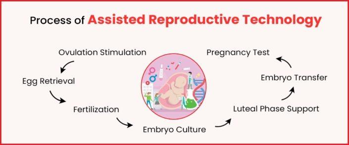 What is Assisted Reproductive Technology - Imprimis IVF