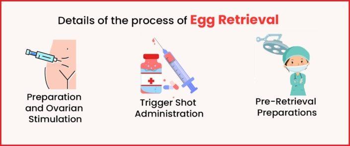 Egg Retrieval Procedure Step-by-Step - Imprimis IVF Centre