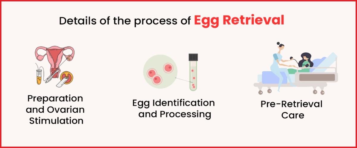 Egg Retrieval Procedure Step by Step Imprimis IVF Centre Egg Retrieval Procedure Step by Step Imprimis IVF Centre