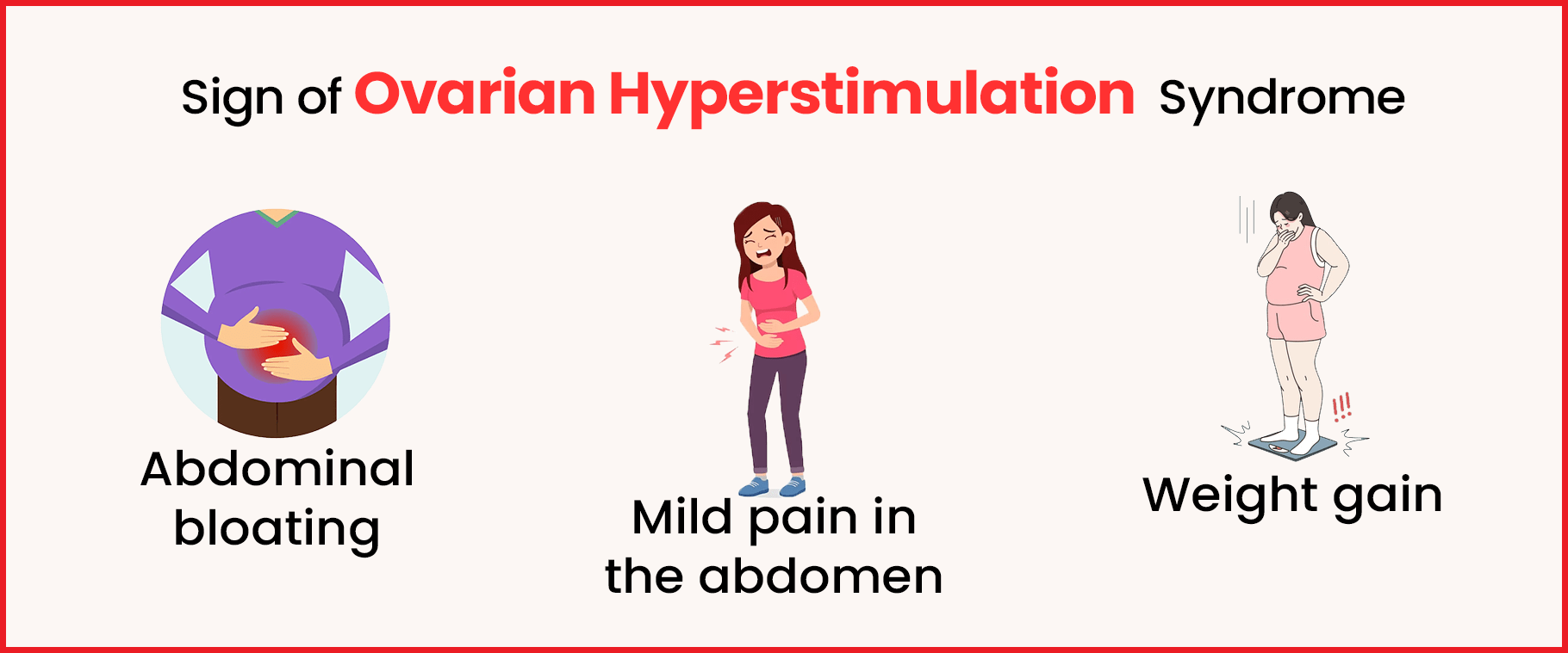 Ovarian Hyperstimulation Syndrome Causes, Symptoms Treatment