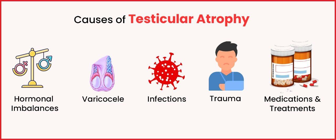 Testicular Atrophy - Causes, Symptoms, Diagnosis and Treatment