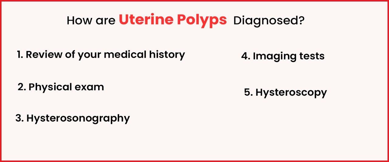 Uterine Polyps Causes, Symptoms and Treatment - Imprimis IVF