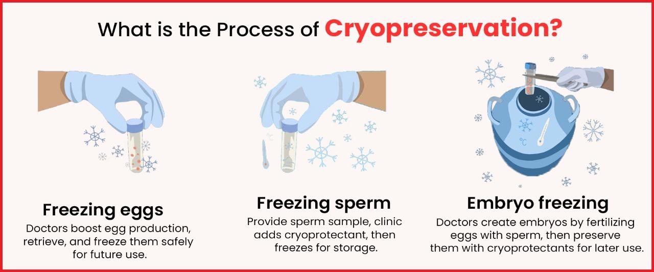Cryopreservation : Freezing of Eggs, Embryos, and Sperms