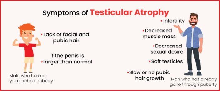 Testicular Atrophy - Causes, Symptoms, Diagnosis and Treatment