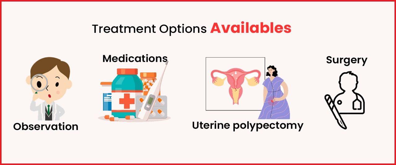 Uterine Polyps Causes, Symptoms and Treatment - Imprimis IVF