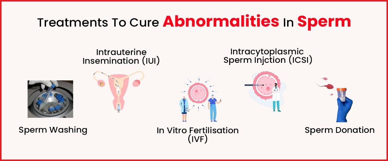 Sperm Abnormalities - Most Common Causes and Treatment