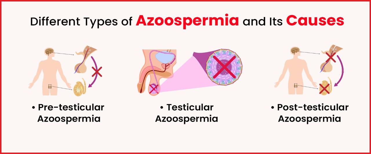 Azoospermia: Causes, Symptoms, Diagnosis & Treatment