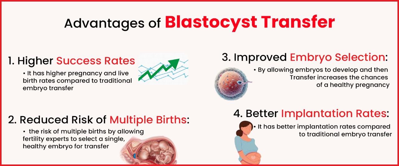 Blastocyst Transfer : Advantages and Success Rates - Imprimis IVF